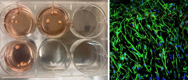 What the Tiny Cluster of Brain Cells in My Lab Are Telling Me - Nautilus